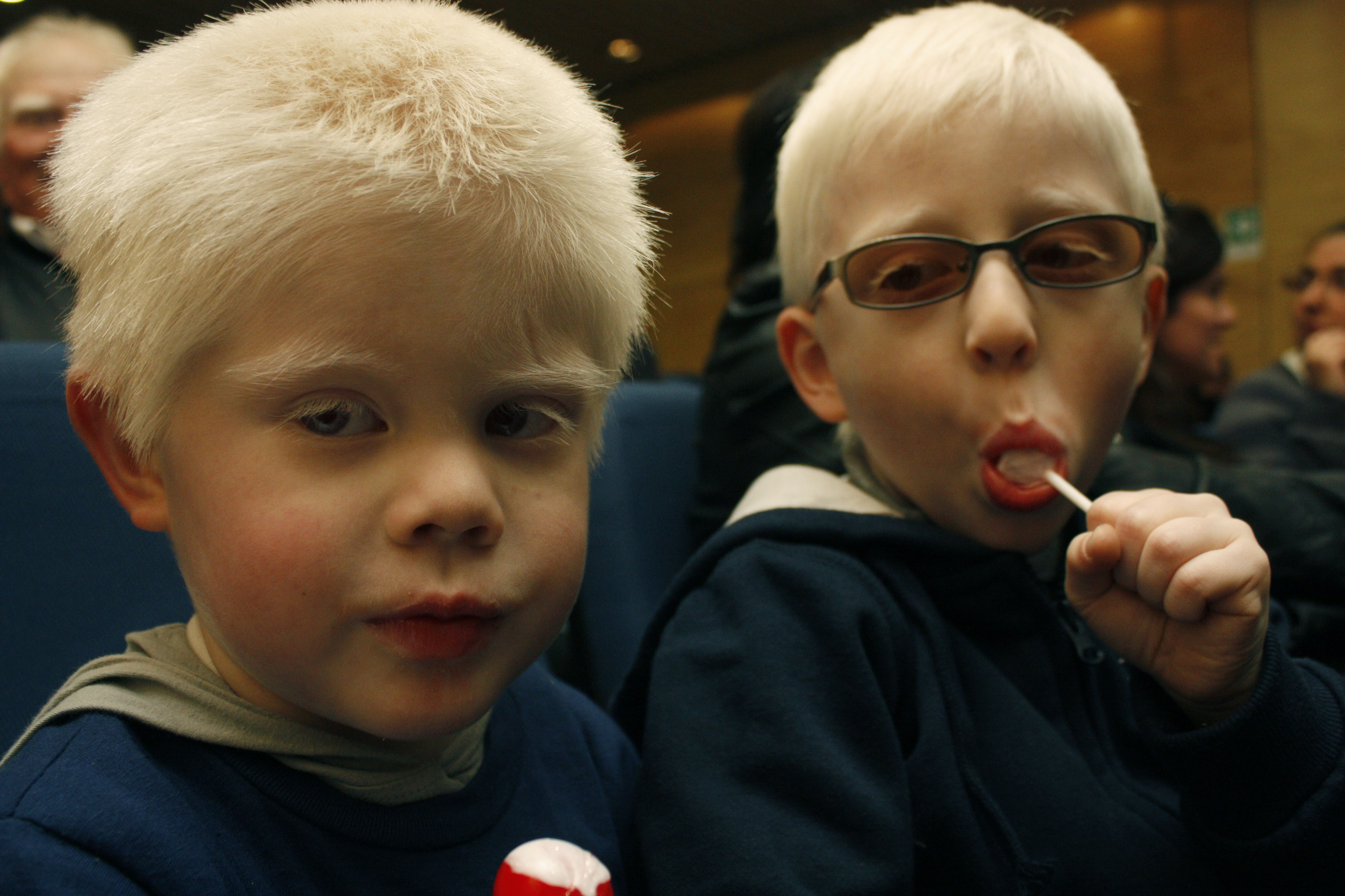 Lanzan el primer censo de albinos en Chile — Radio Concierto Chile
