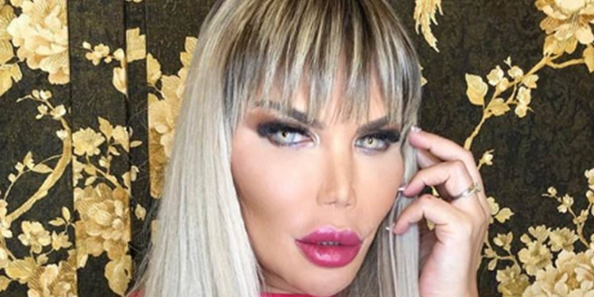 Ken Humano es captado besándose con su cirujano — Radio Concierto Chile